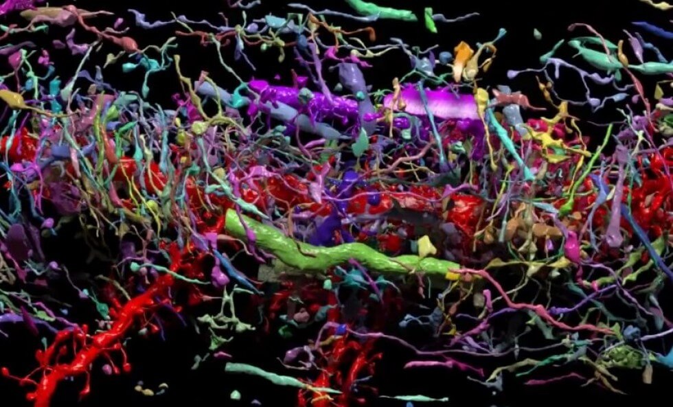 Zoom to Nano-resolution of Brain with New Imaging Tool – Technology Vista